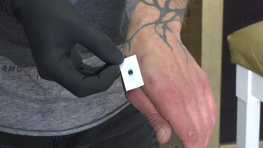 Peltse biohacker implanteert onderhuidse microchips om elektronica te ...